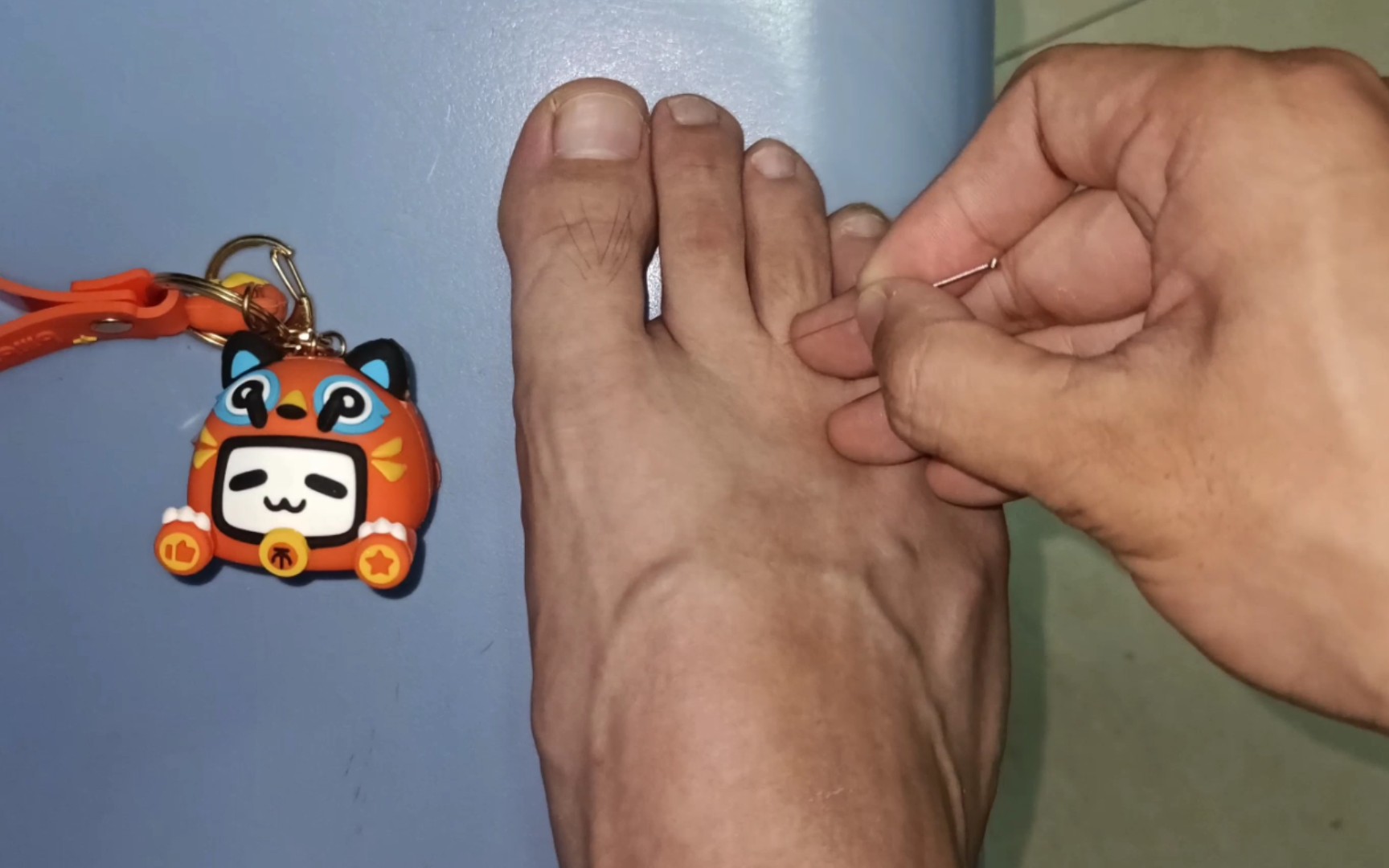 5.内庭穴 针刺练习