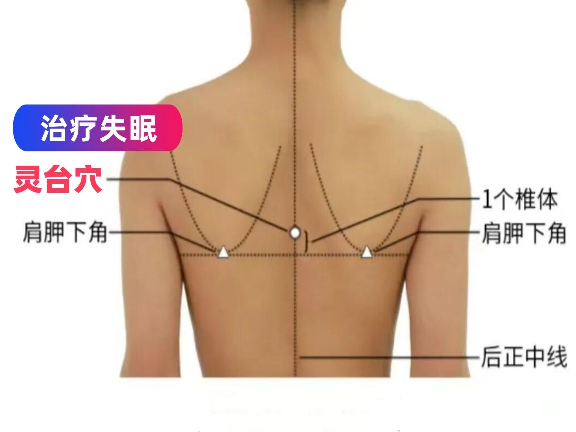 212、督脉 — 灵台穴 — 治疗失眠好帮手