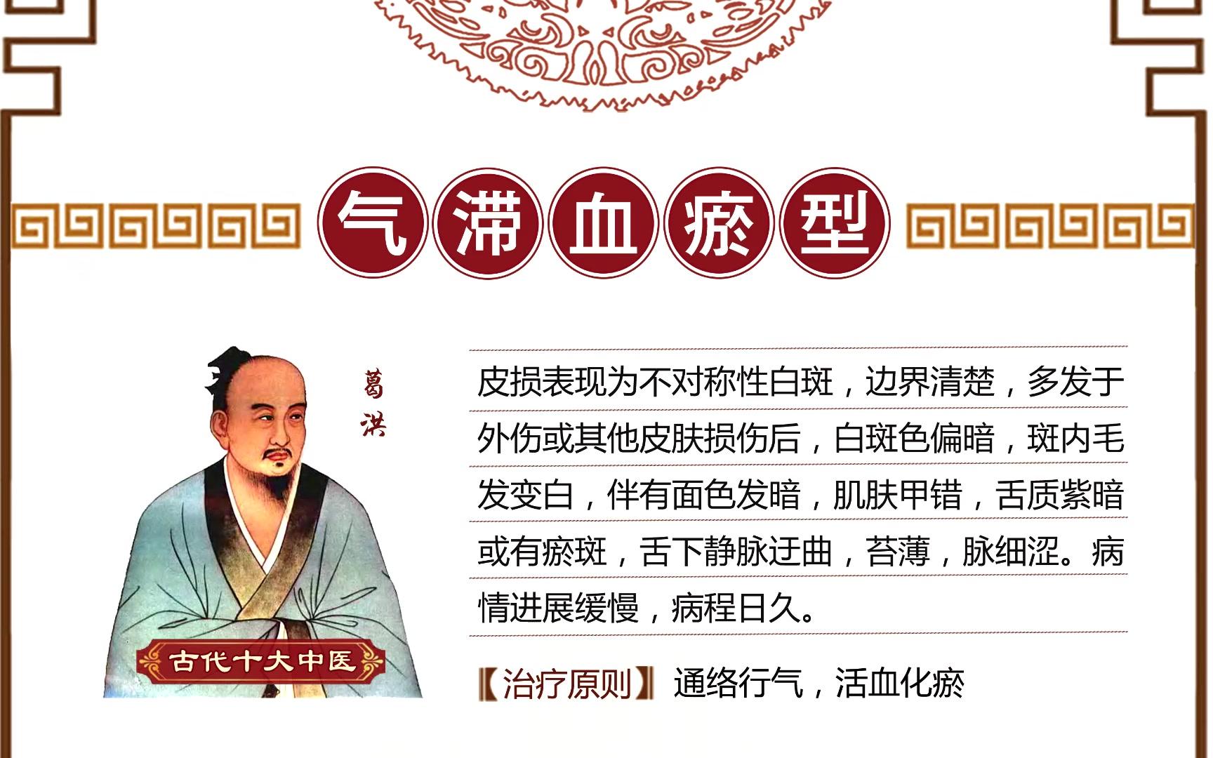 中医白癜风案例分享:气滞血瘀型