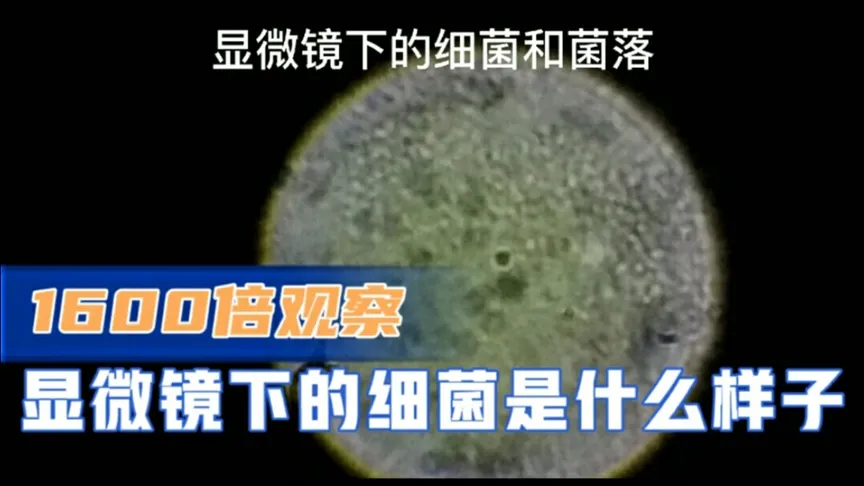 显微镜下的细菌是什么样子