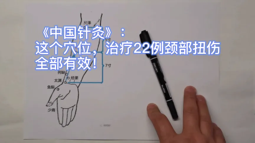 神奇的穴位——经渠穴,这么好的穴位,你应该知道。