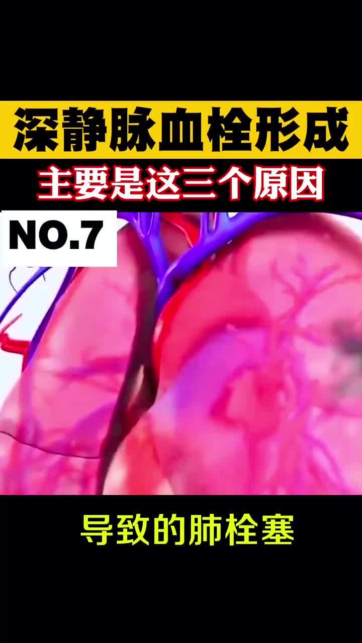 深静脉血栓是怎么形成的呢?看看这三个原因,你了解多少呢 医学科普 .