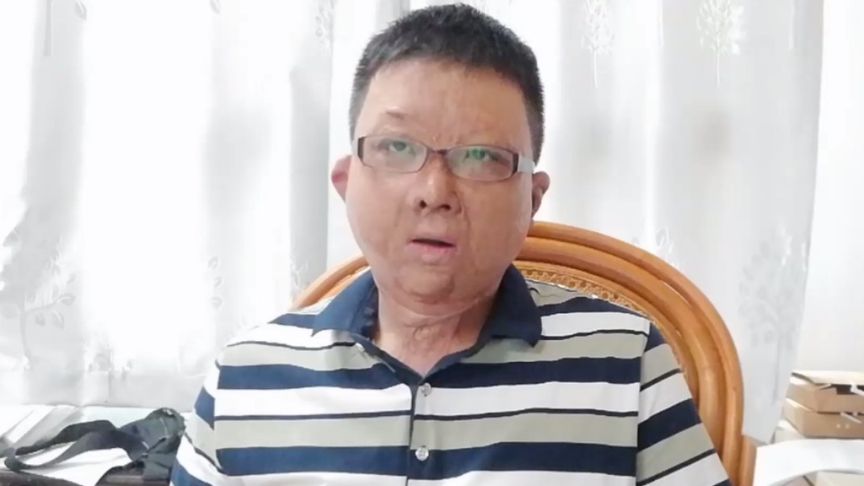 残疾证的含金量之五,辅助器具优惠政策