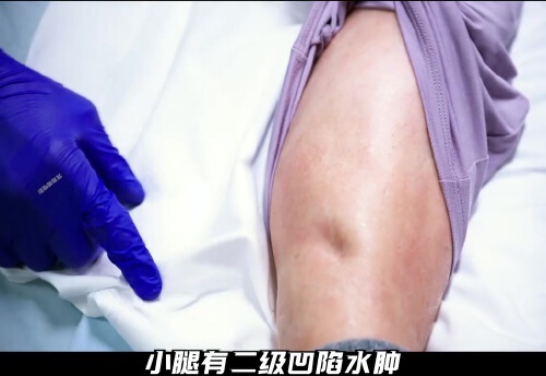 医生拼尽全力抢救病人的生命可得到的不是夸奖竟是家属的破口大骂