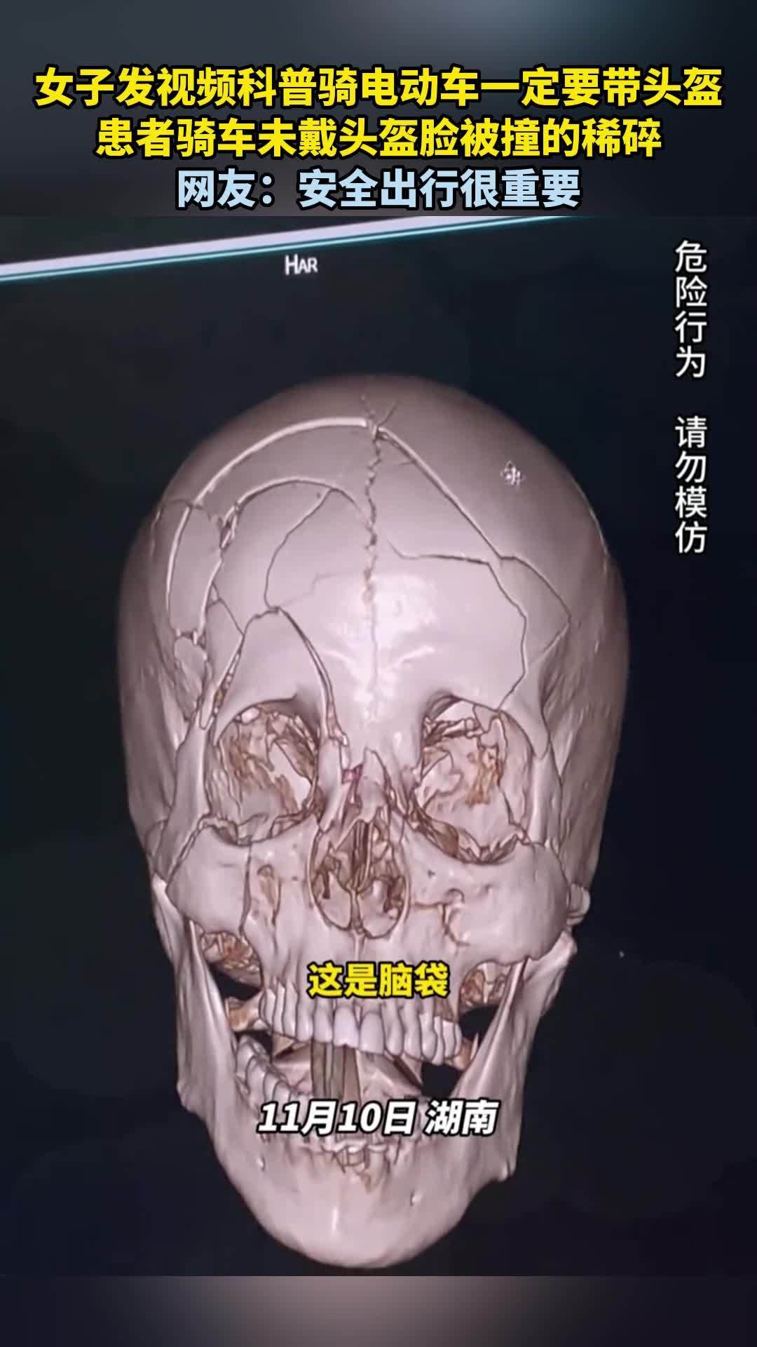 女子发视频科普骑电动车一定要带头盔,安全出行很重要。