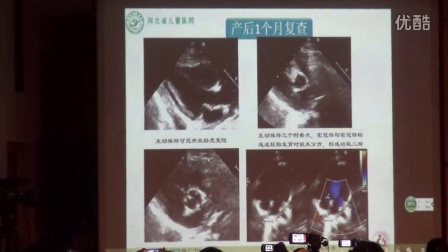 15.胎儿先天性心脏畸形产前产后一体化管理分析-董凤群(河北省儿童...