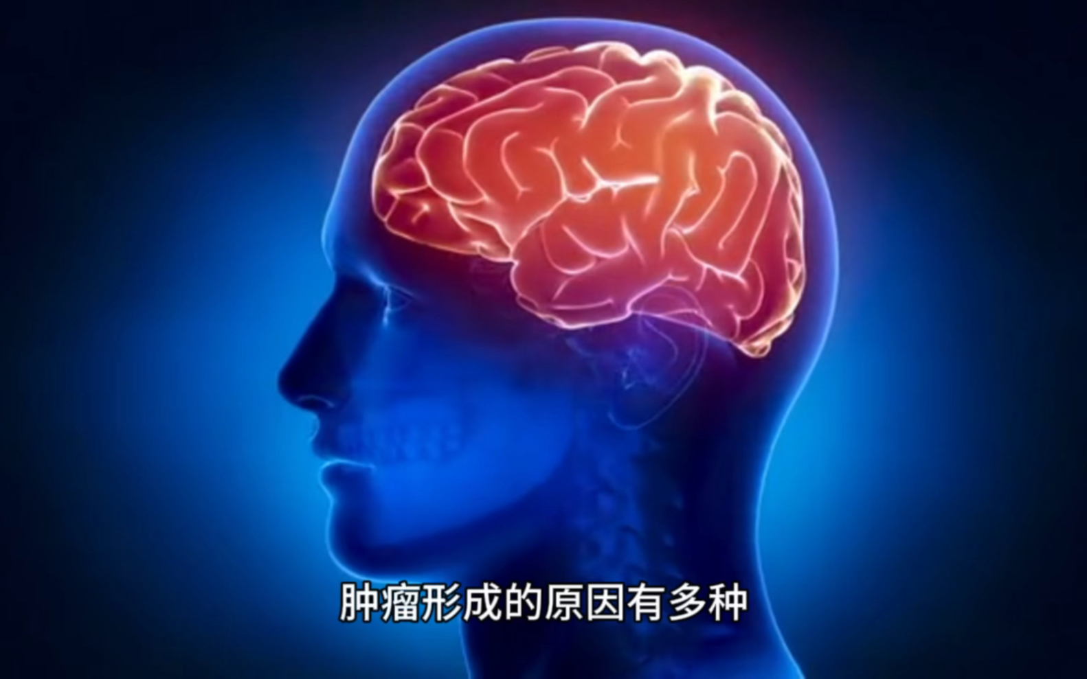 肿瘤形成的原因?