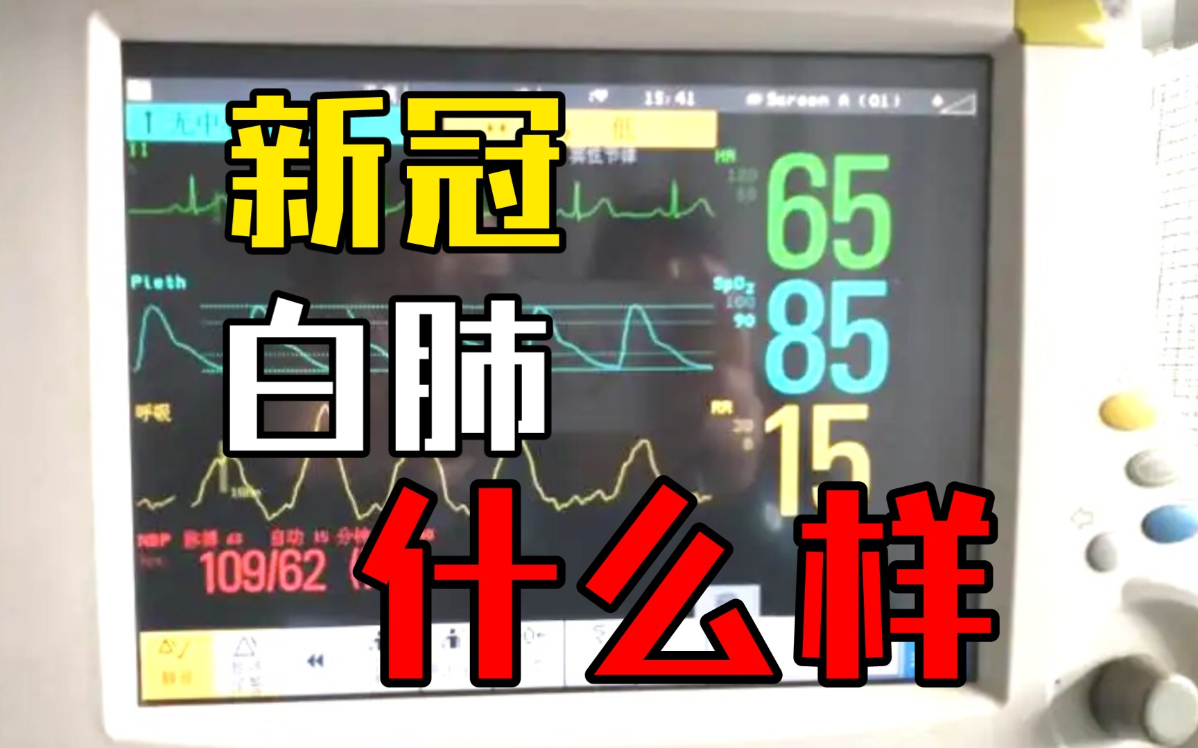 气短愈发明显,血氧持续走低:警惕白肺