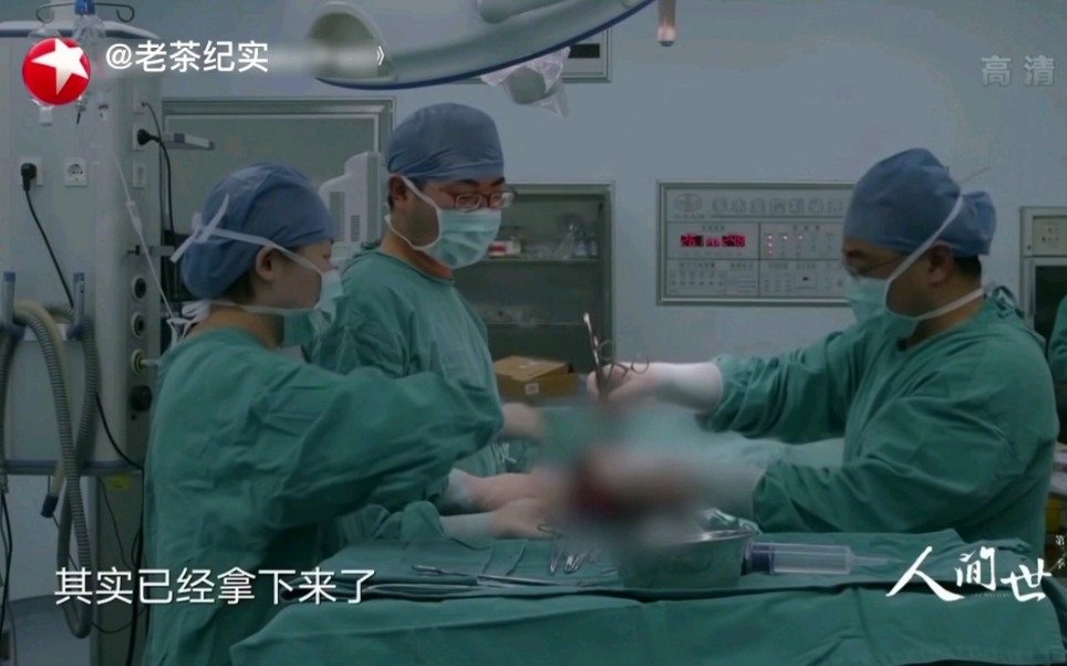 实拍医院器官移植手术,纪录患者和家属最真实的心理状态!