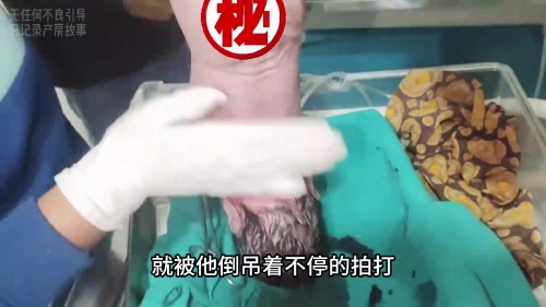 紧急抢救新生儿:医生的坚定与不屈,生命奇迹的诞生