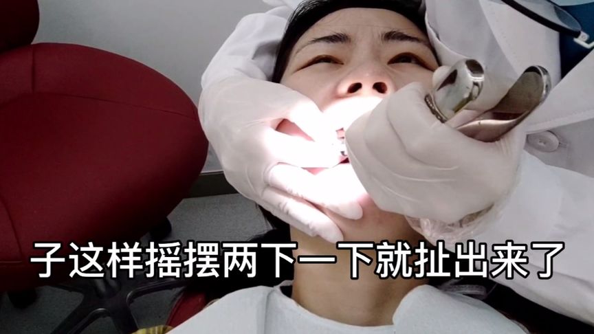 潘潘终于鼓起勇气去医院做正畸了,记录一下今天拔正畸牙过程