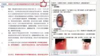护理个案书写与制作-黄淑俊