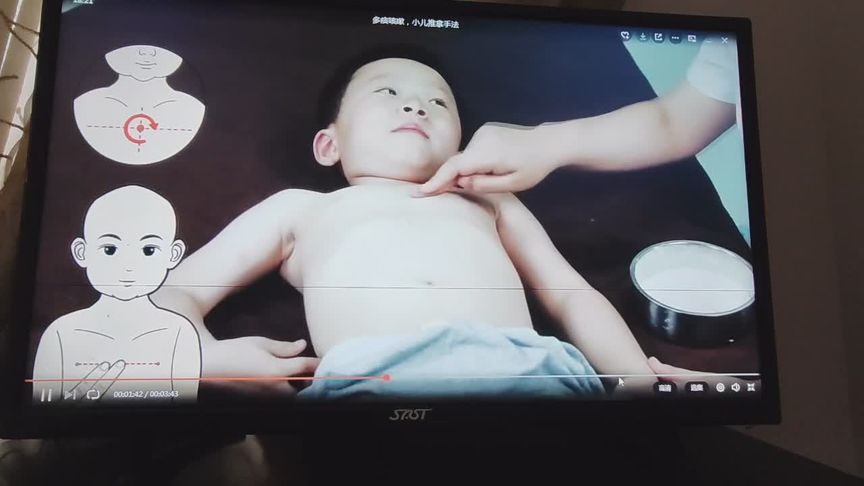 小儿多痰咳嗽常用推拿手法