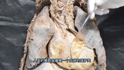 将前胸的骨骼和皮肤组织去除后,胸腔内的器官结构