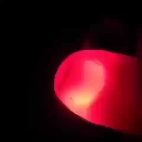 【毛细血管搏动征阳性】#爱问好奇心# 检查者用手指轻压患者指甲...