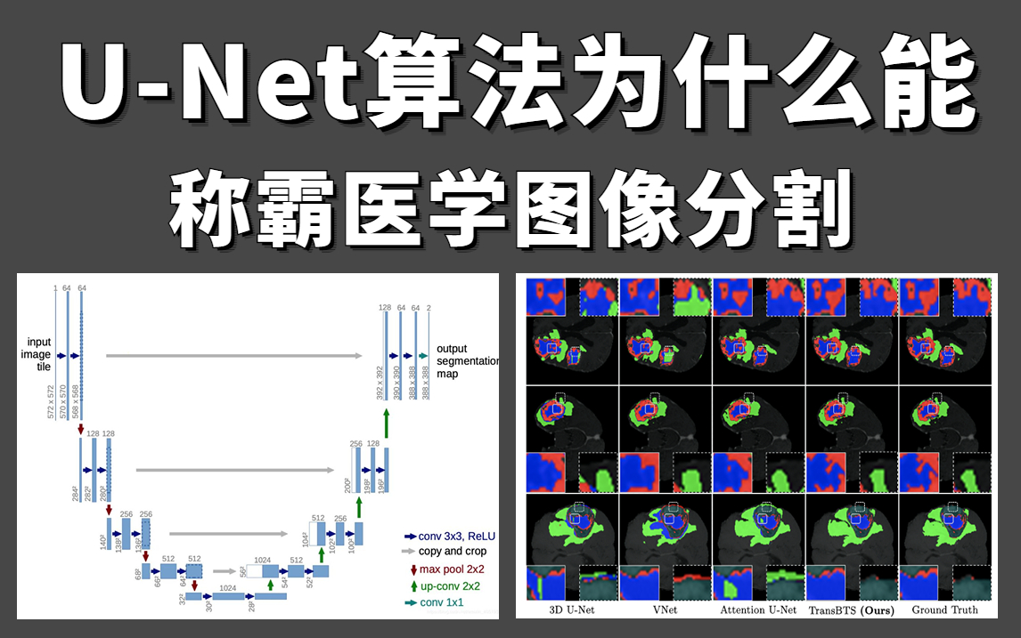 U-Net算法为什么能够称霸医学图像分割领域!基于U-Net的医学图像...