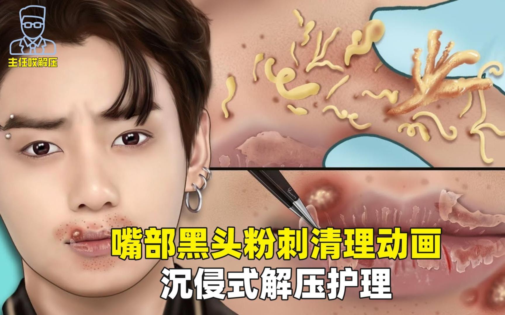 解压动画,嘴部黑头粉刺清理动画,沉侵式解压护理