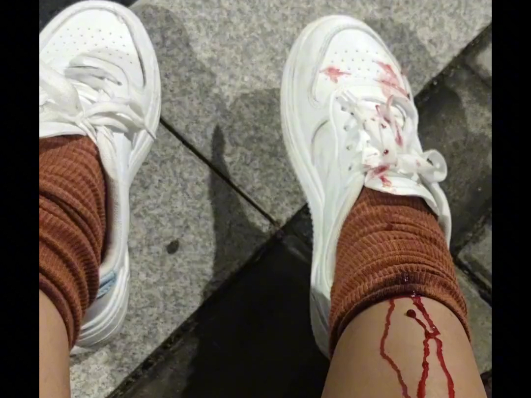 最新摩托车事故!现场视频