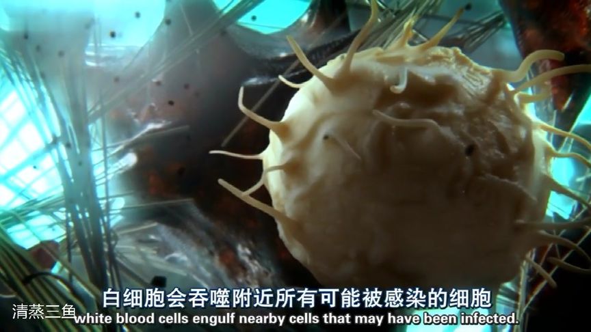 白细胞组织的一场大型病毒歼灭战,导致了我们鼻塞