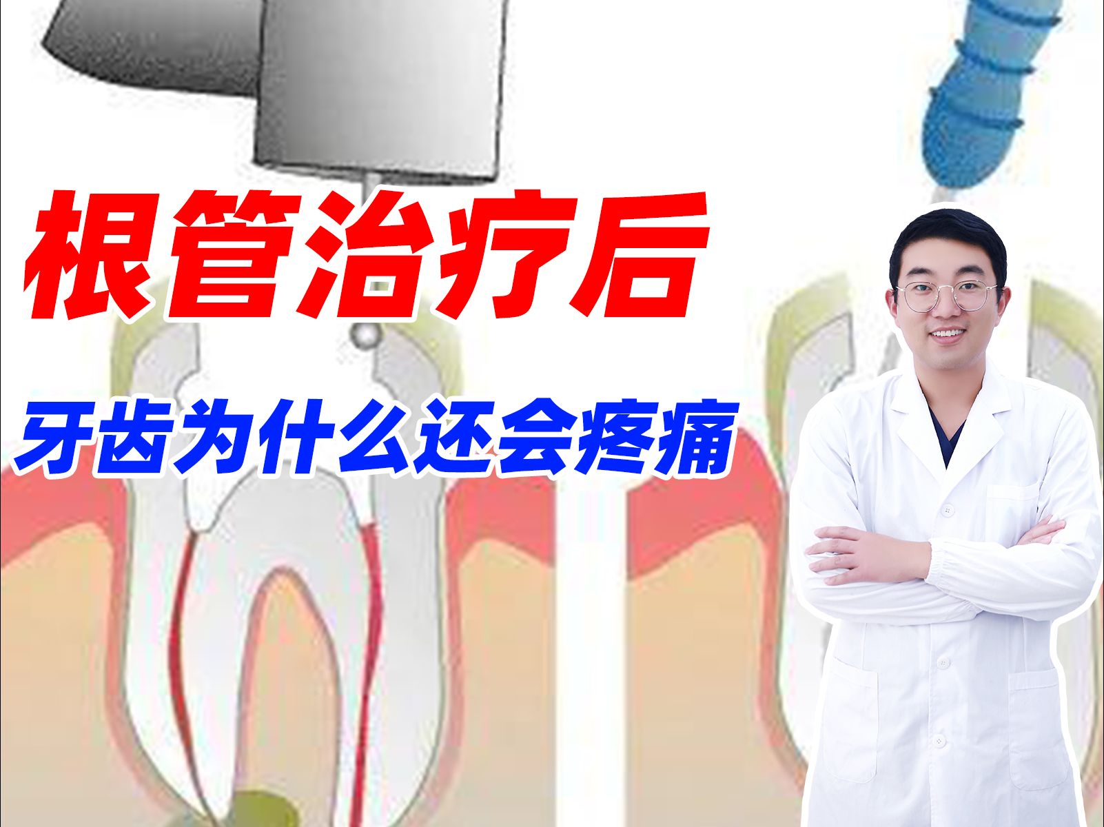 根管治疗后牙齿有出现疼痛是为什么?