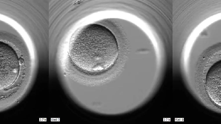 试管婴儿:记录胚胎发育全过程