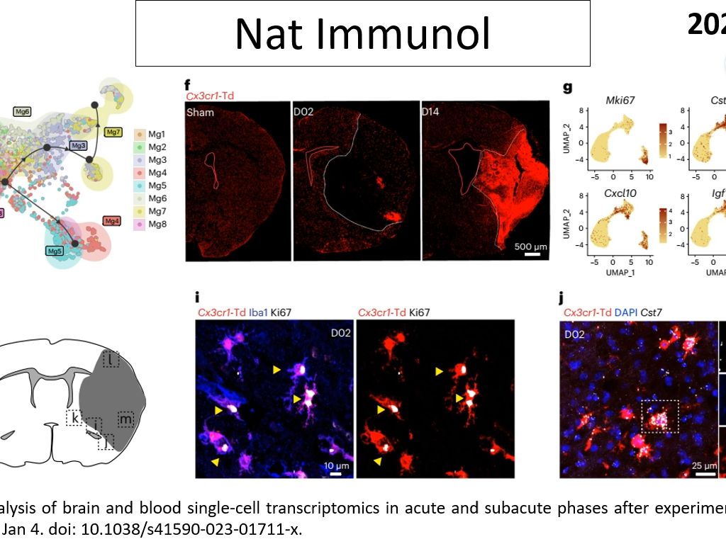Nat Immunol—单细胞组学重磅:科学家发布急性期和亚急性期缺血性脑...