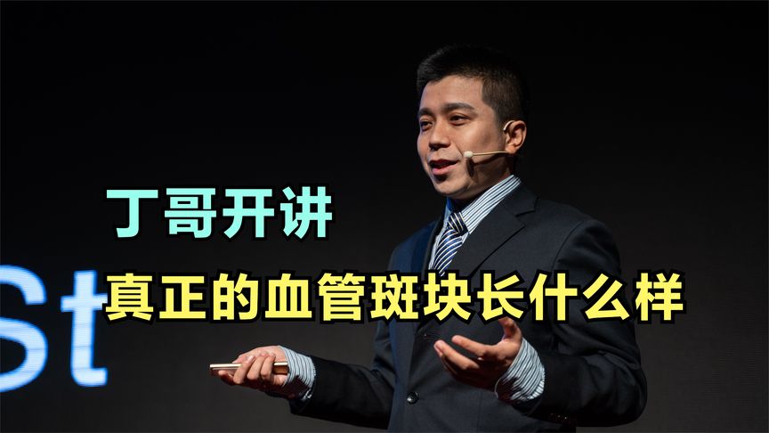 丁哥开讲:真正的血管斑块长什么样。
