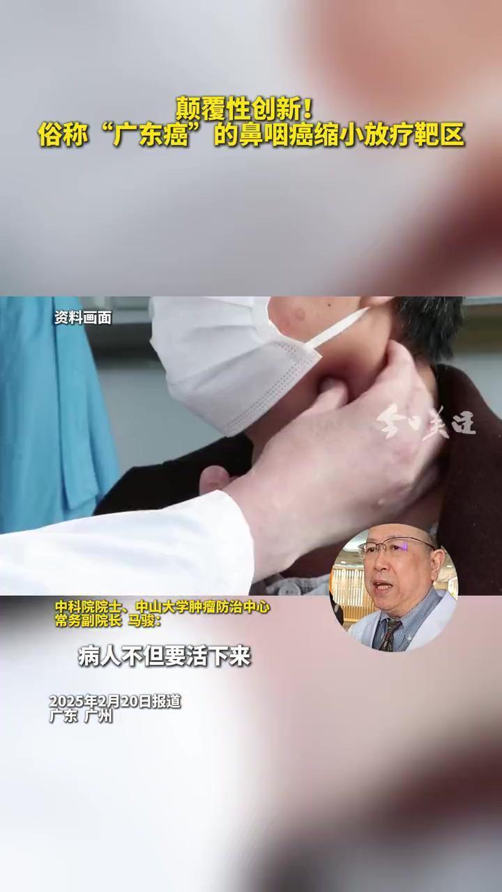 颠覆性创新!俗称"广东癌"的鼻咽癌缩小放疗靶区