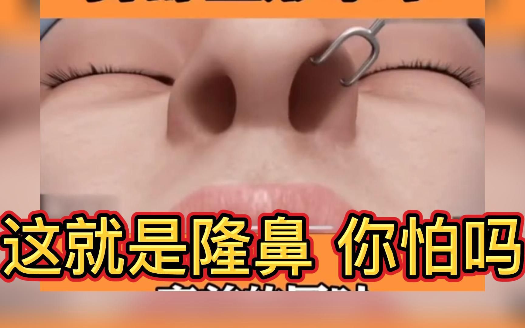 【胆小勿进!】做鼻子的全过程,你怕了吗?
