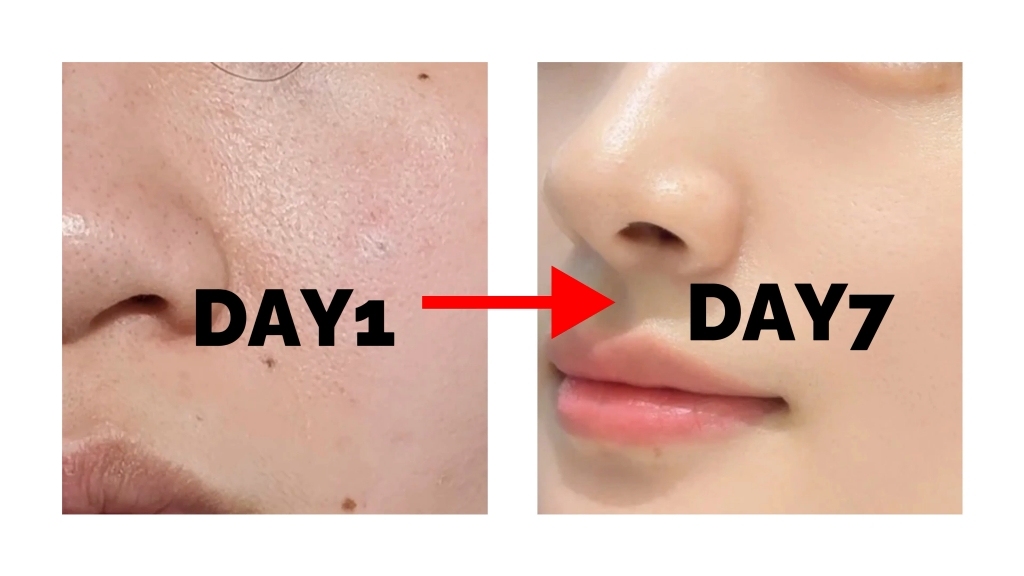 【皮肤调理专针】1-7日 干净无暇的肌肤 修复 刷酸 鸡蛋一般嫩的肌肤 ...