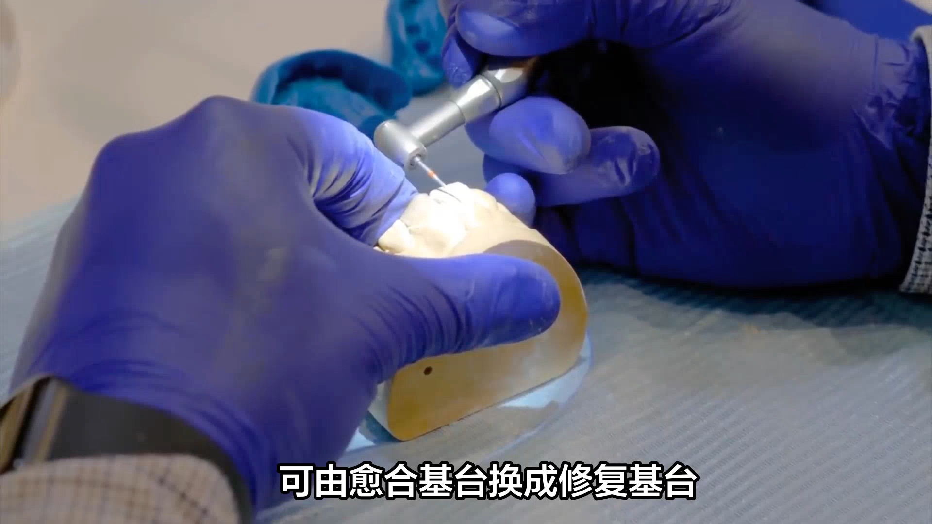 七个步骤了解种植牙全过程