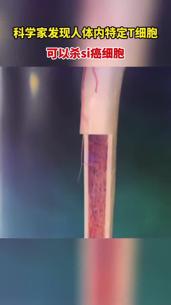 科学家发现人体内特定T细胞可以消灭癌细胞,未来癌症能被攻克?