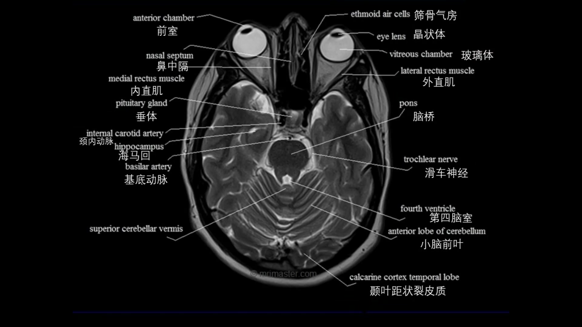 头颅MR横断面解剖中英文对照版,音乐+影像+解剖原来是另一番新天地