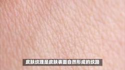 什么是皮肤纹理与皮肤张力线?