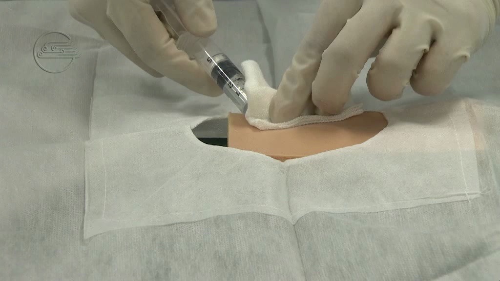 体表肿物切除术--完整版教学视频