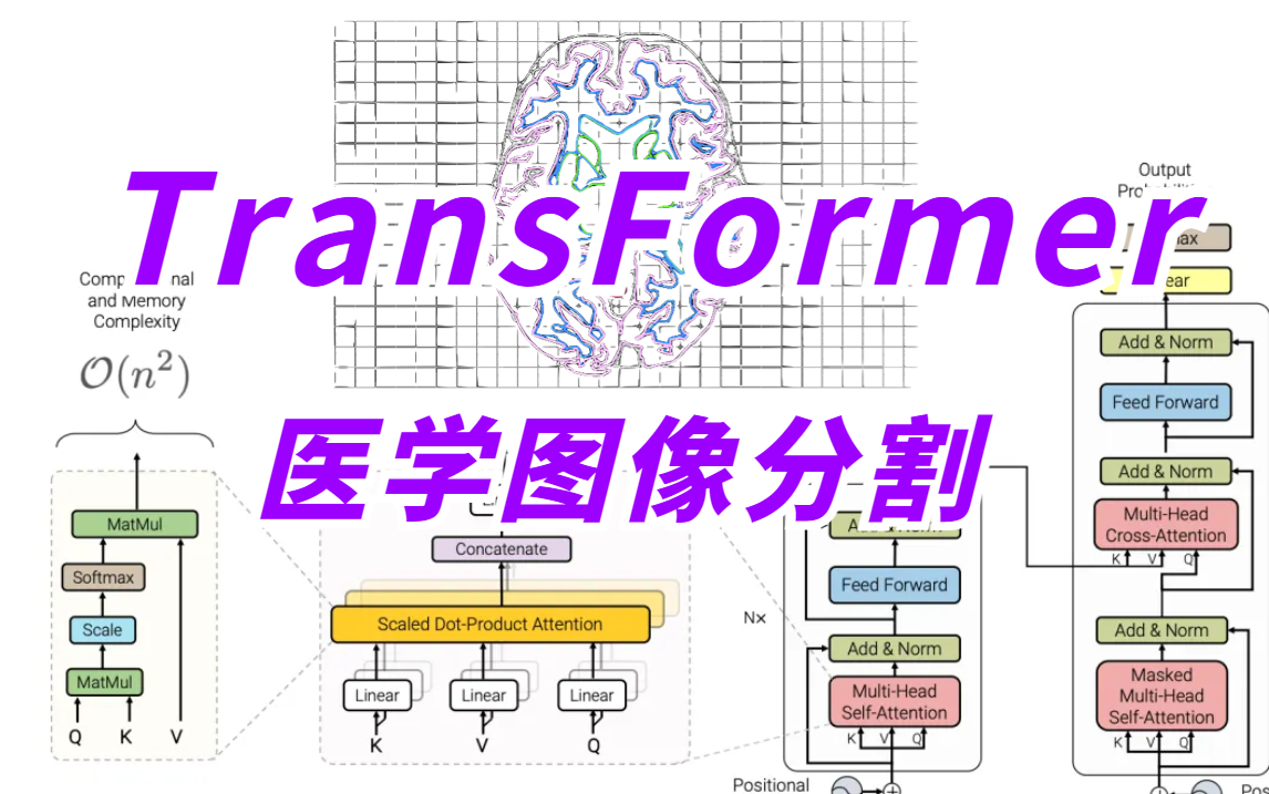 ...4小时就入门了Transformer实战!基于Transformer的医学图像分割教程...