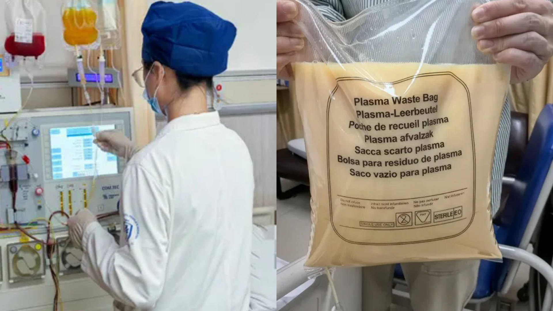 男子体内滤出7斤"油",当场吓懵:这么一大袋!一顿聚餐让他懊悔不已