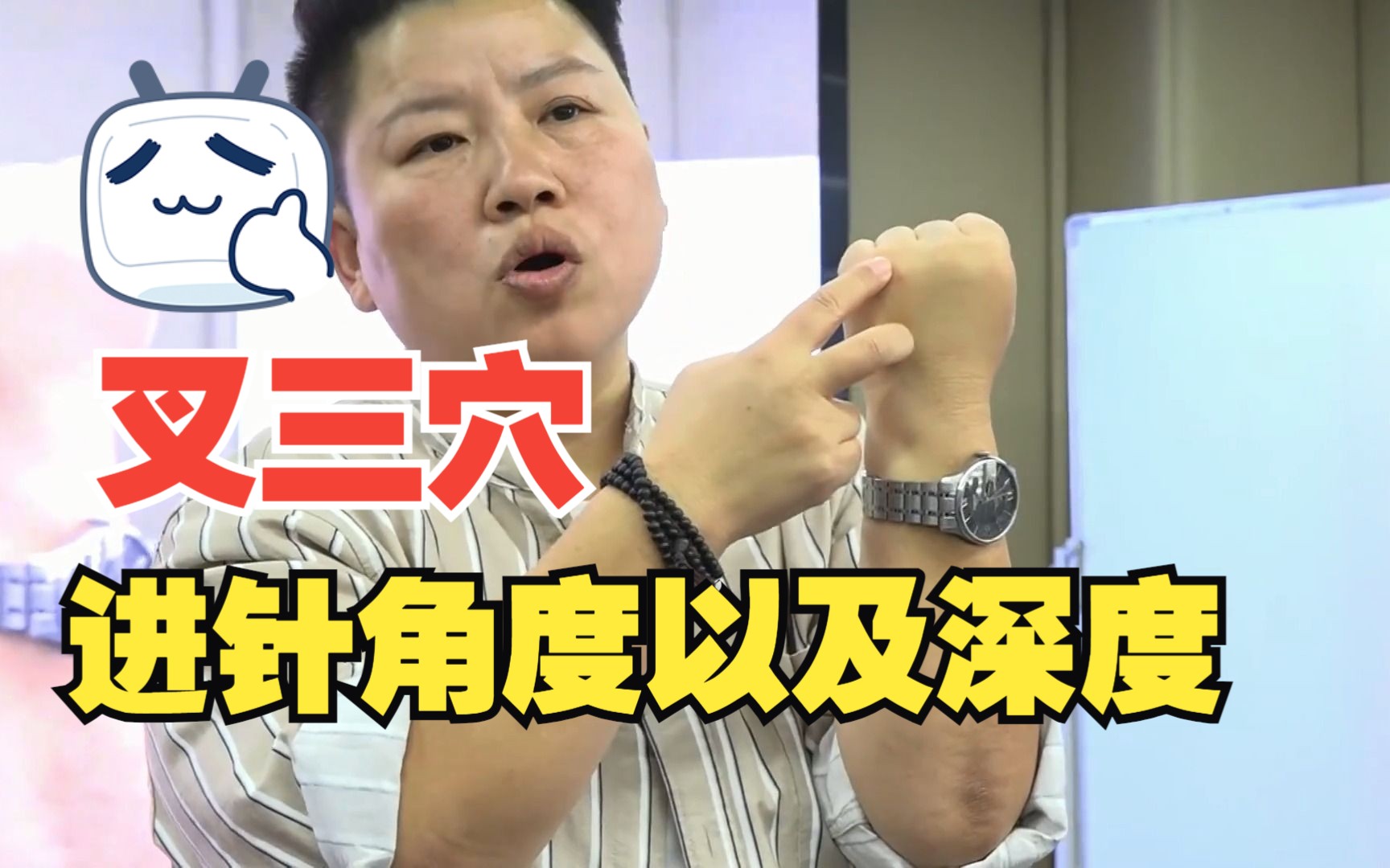刘红云老师讲叉三穴的进针方法及功效!刘红云针灸视频全集!董氏奇穴!