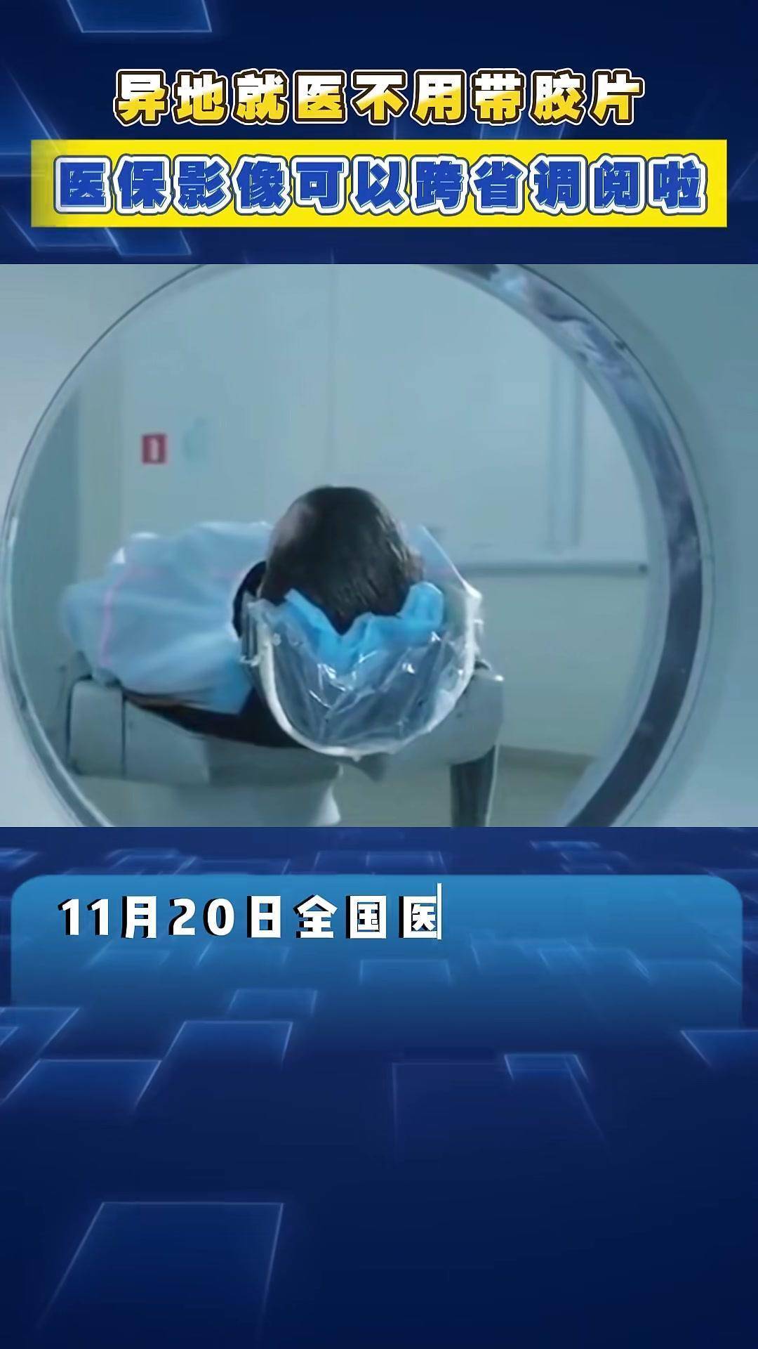 异地就医不用带胶片医保影像可以跨省调阅啦#医疗#民生#影像