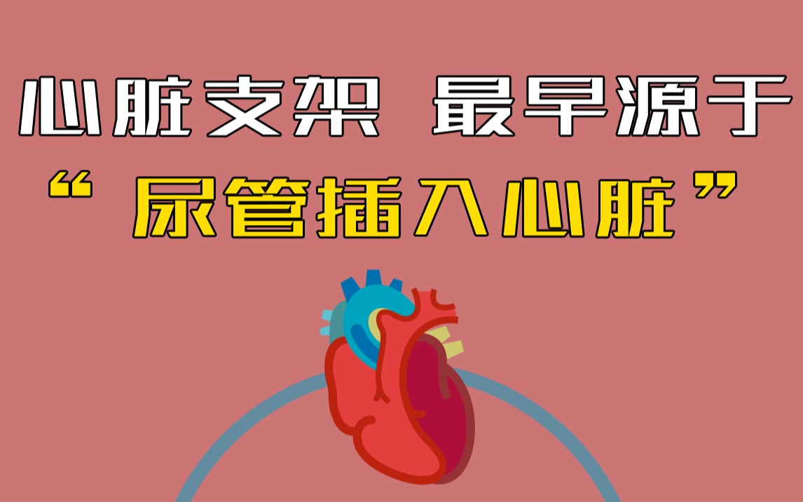 全球超1.3亿冠心病人或需安装支架,它最早源于尿管插入心脏