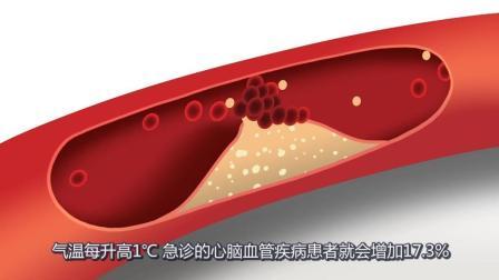 三伏天是心脑血管疾病危险期,做到这四点,减少疾病死亡率