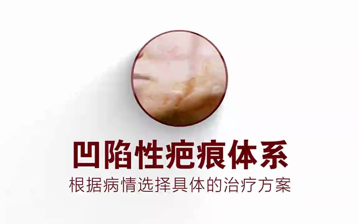 凹陷性疤痕过来看看治疗方案