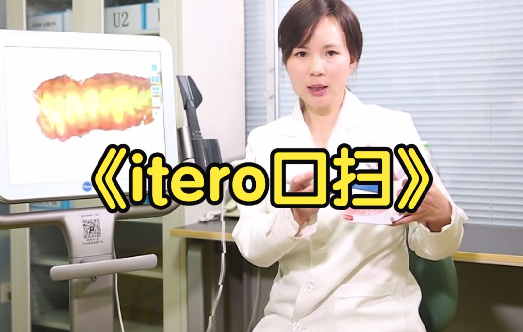 itero口扫比传统取模好在哪?