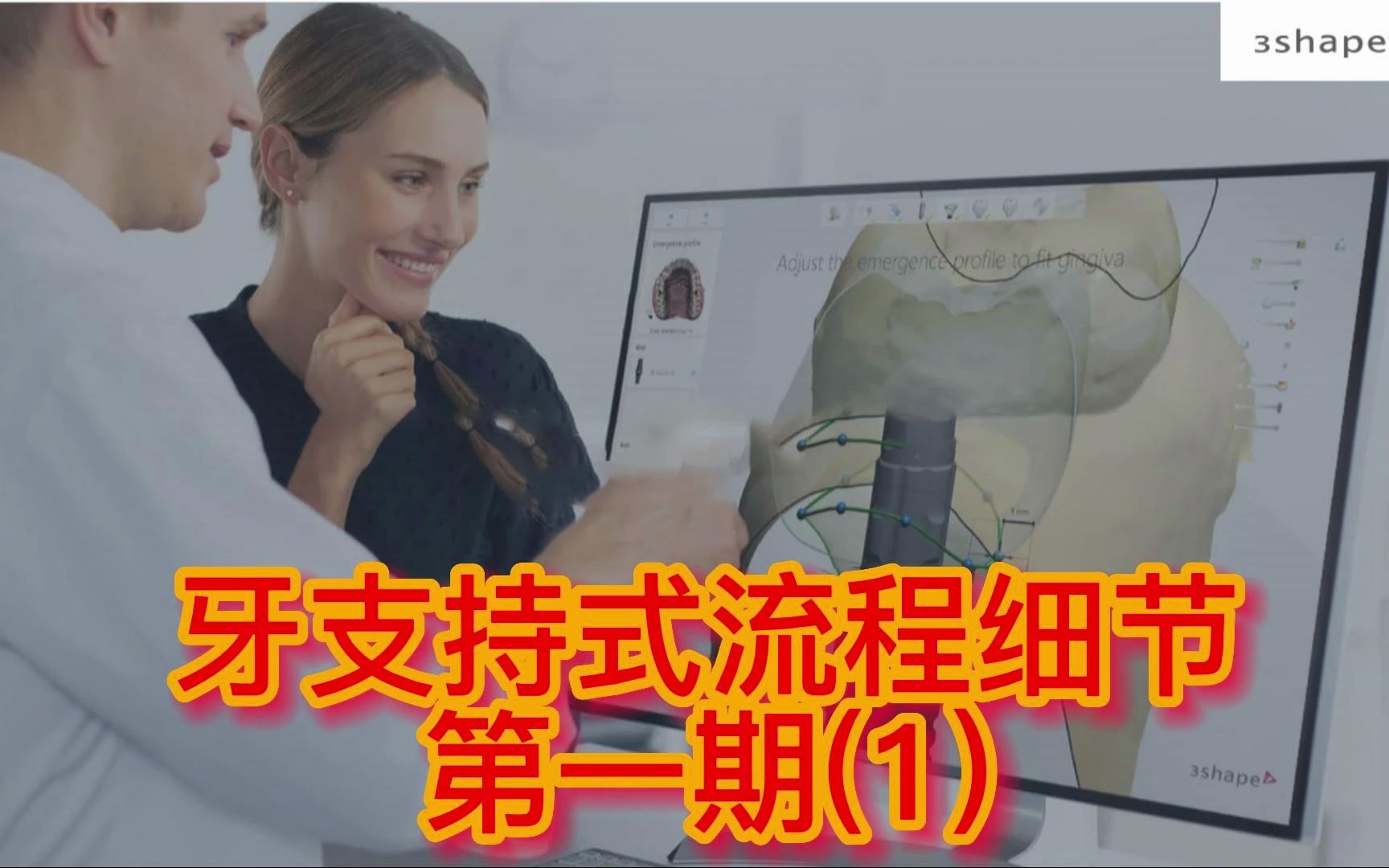 3shape 牙支持式流程细节 第一期 种植导板教程