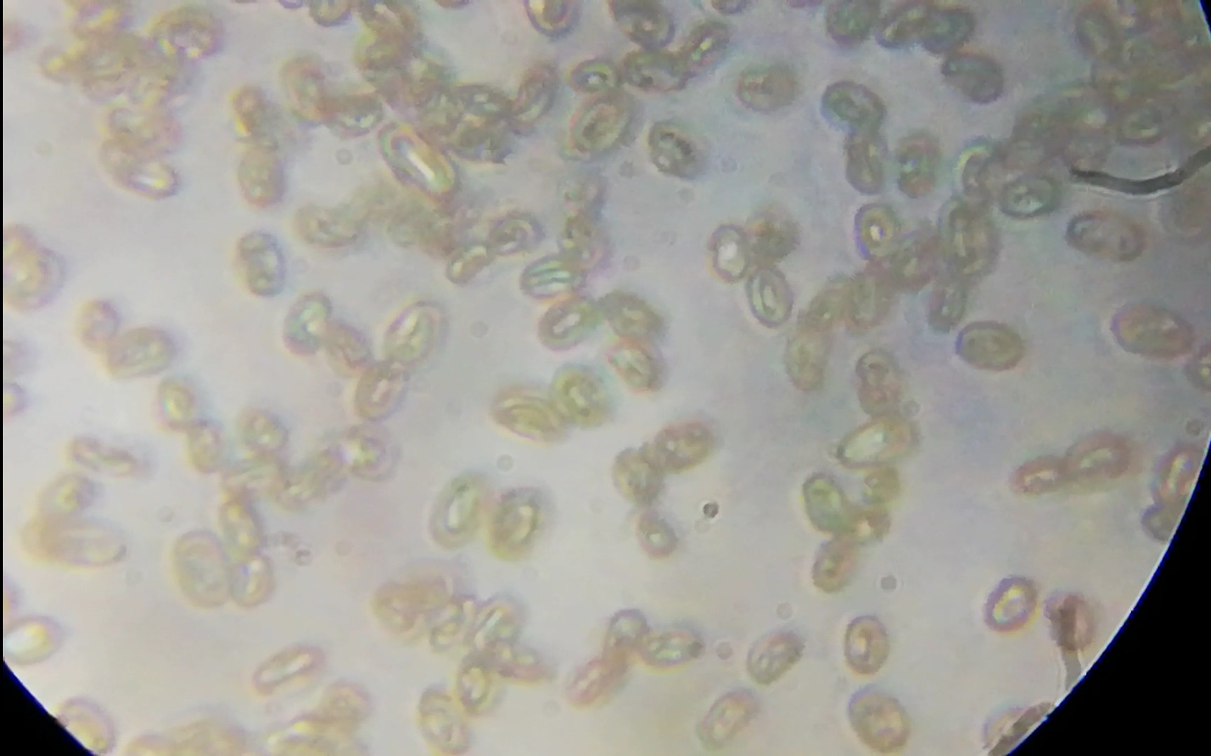 【微生物细胞】青霉菌密恐福利显微镜下世界第一集