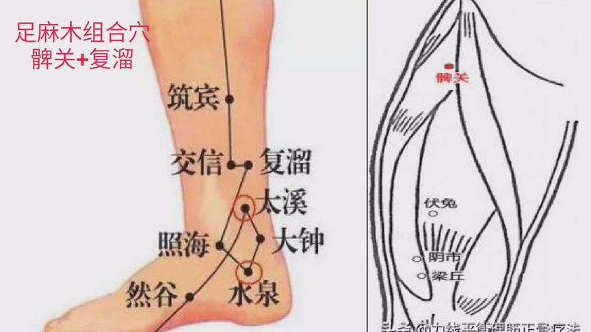 足麻木组合穴 髀关+复溜