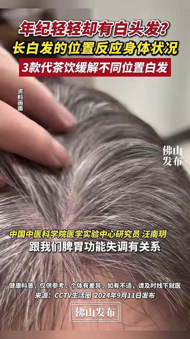 年纪轻轻却有白头发?长白发的位置反应身体状况!3款代茶饮缓解不同...