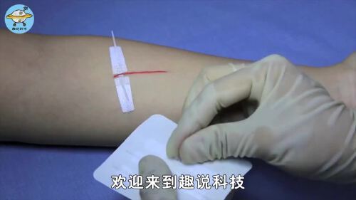 如何实现无针缝伤口?1分钟了解拉链式创可贴看完长见识了