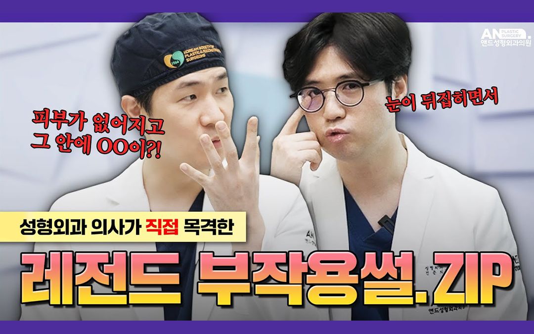 医生亲眼目睹的最糟糕的整容副作用故事。(ft. 后开眼角、填充物、...