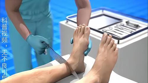 世界上最奇葩的医疗事故